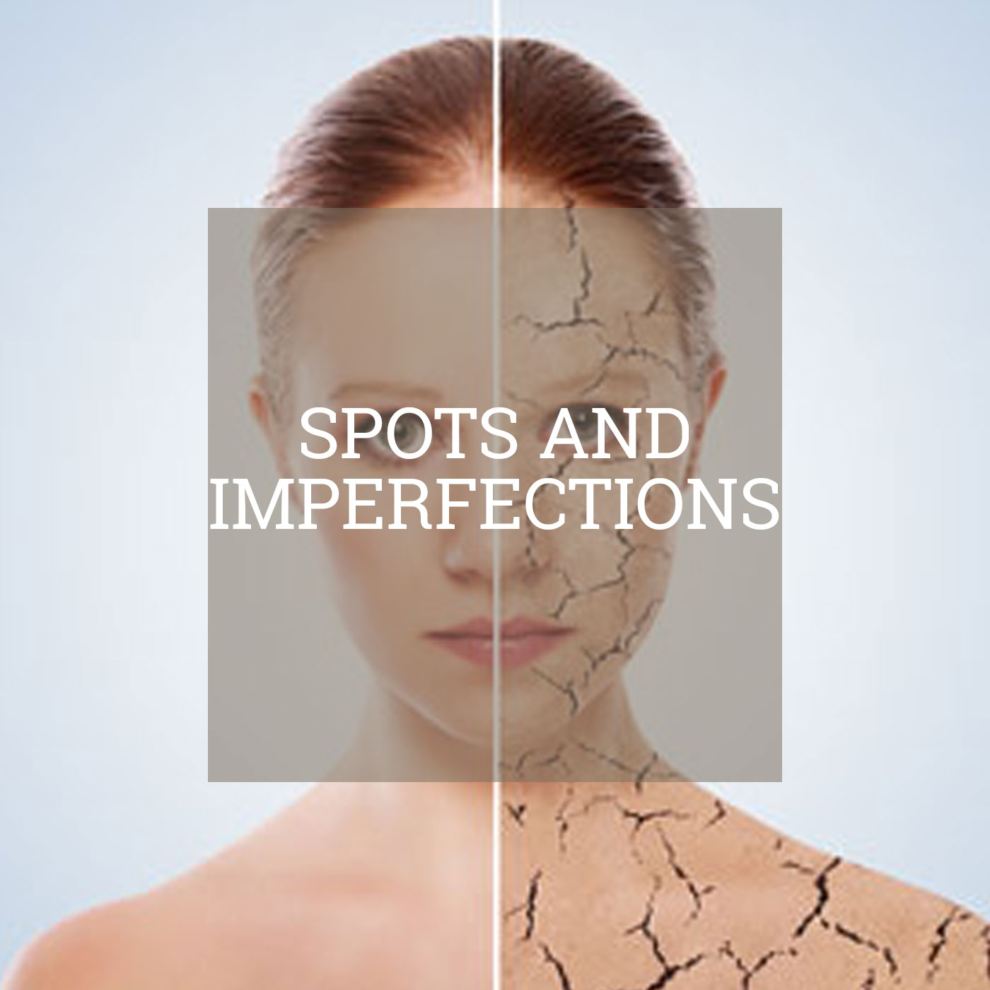 Spots and imperfections - Epidermos Instituto de dermoestética